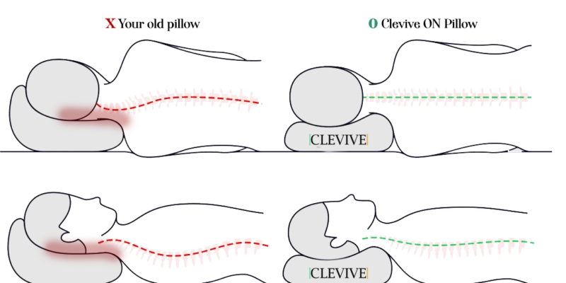 Clevive™ Occipital Neuralgia Pillow – Clevive